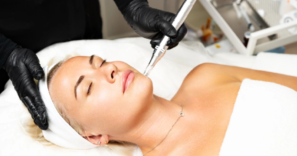 How SkinPen Microneedling Stimulates Collagen Production?